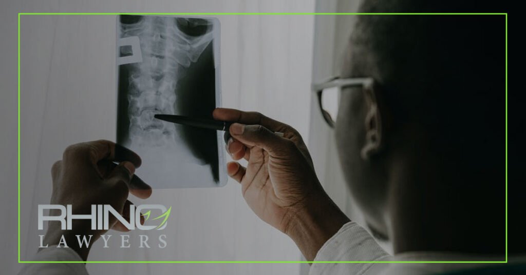 Long-Term Spinal Cord Injury Consequences | RHINO Lawyers